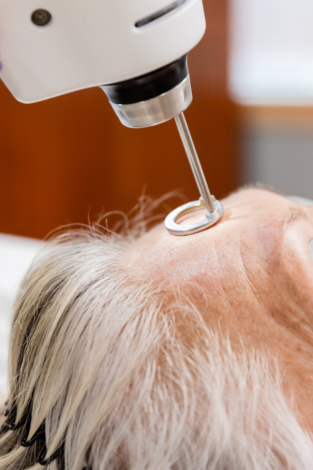 Laser Skin Treatment in Wheeling | ThrIVe Wheeling